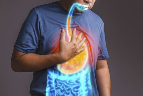 Reflux gastro-oesophagien - Gastro-entérologue Lyon